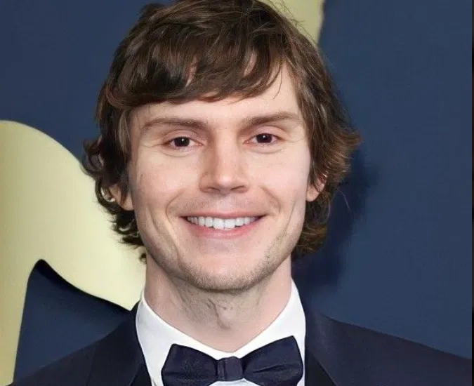Evan Peters' Smile Evolution: From Natural to Hollywood | LEMA