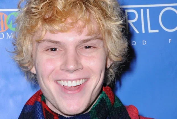 Evan Peters' Smile Evolution: From Natural to Hollywood | LEMA