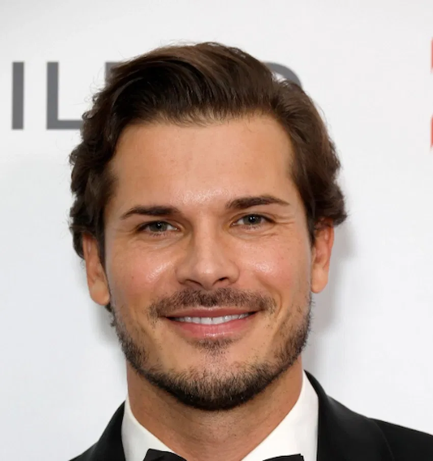 Gleb Savchenko Smile: Kiedy jego zęby zostały naprawione