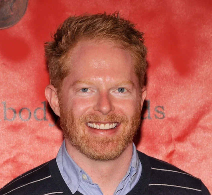 Jesse Tyler Ferguson Teeth (Old/New): Before and Afters | LEMA
