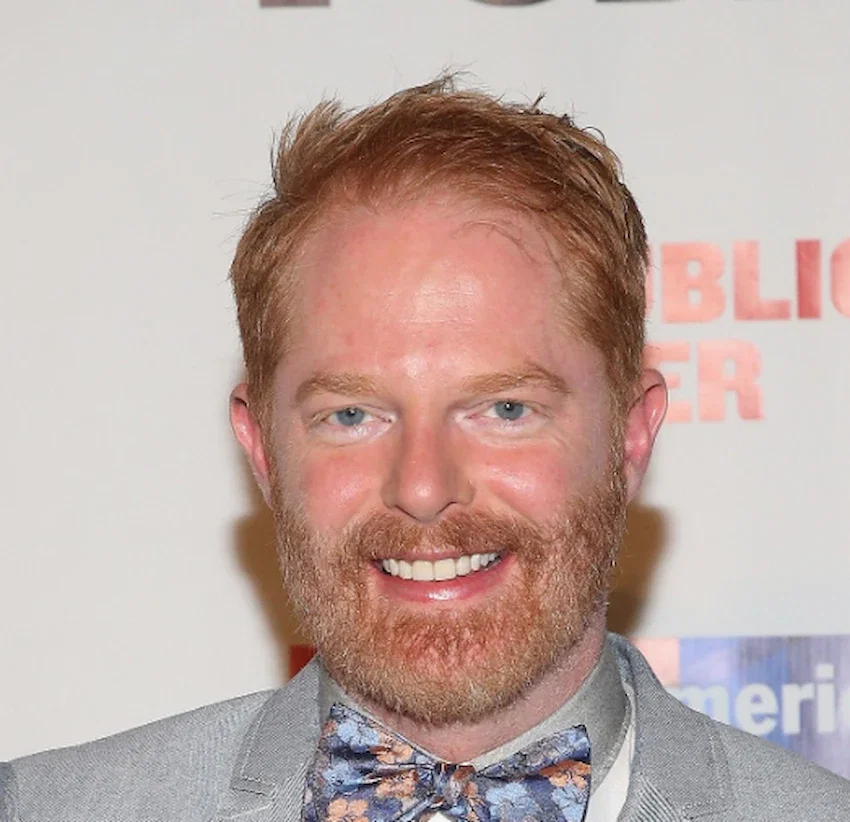 Jesse Tyler Ferguson Teeth (Old/New): Before and Afters | LEMA