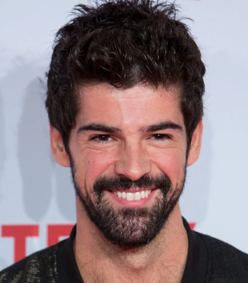 Miguel Angel Munoz's Teeth Makeover: Full Transformation | LEMA