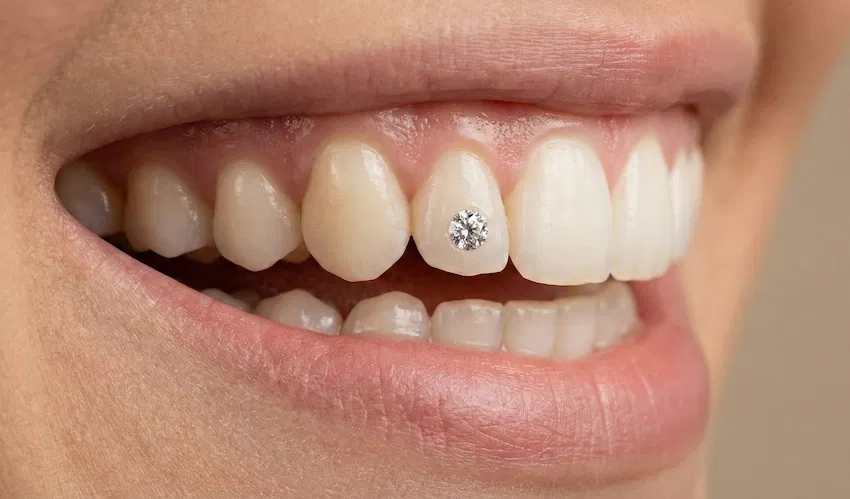 Diamond Tooth Gem vs. Crystal Tooth Gem: Which One? | LEMA