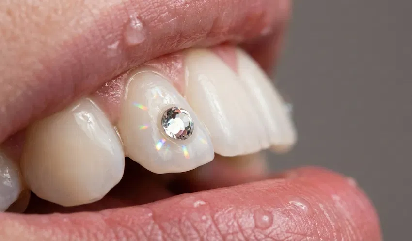 Diamond Tooth Gem vs. Crystal Tooth Gem: Which One? | LEMA