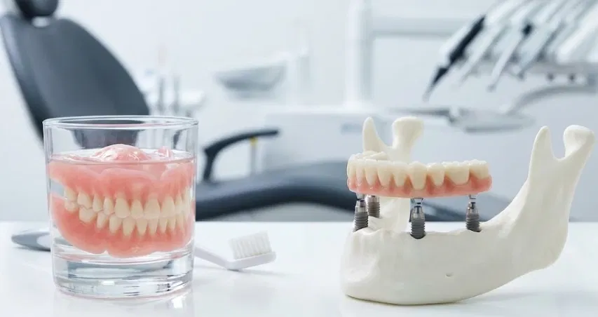 Fixed vs. Removable Dentures: Comparing Comfort and Functionality | LEMA