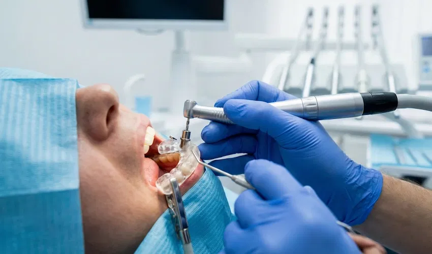 What Is Guided Implant Surgery? | LEMA