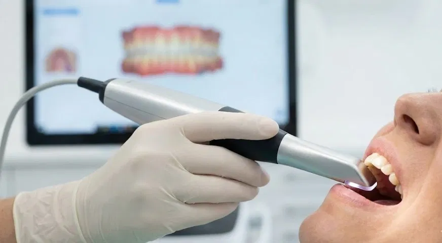 Digital Smile Design: Test-Drive Your New Smile | LEMA